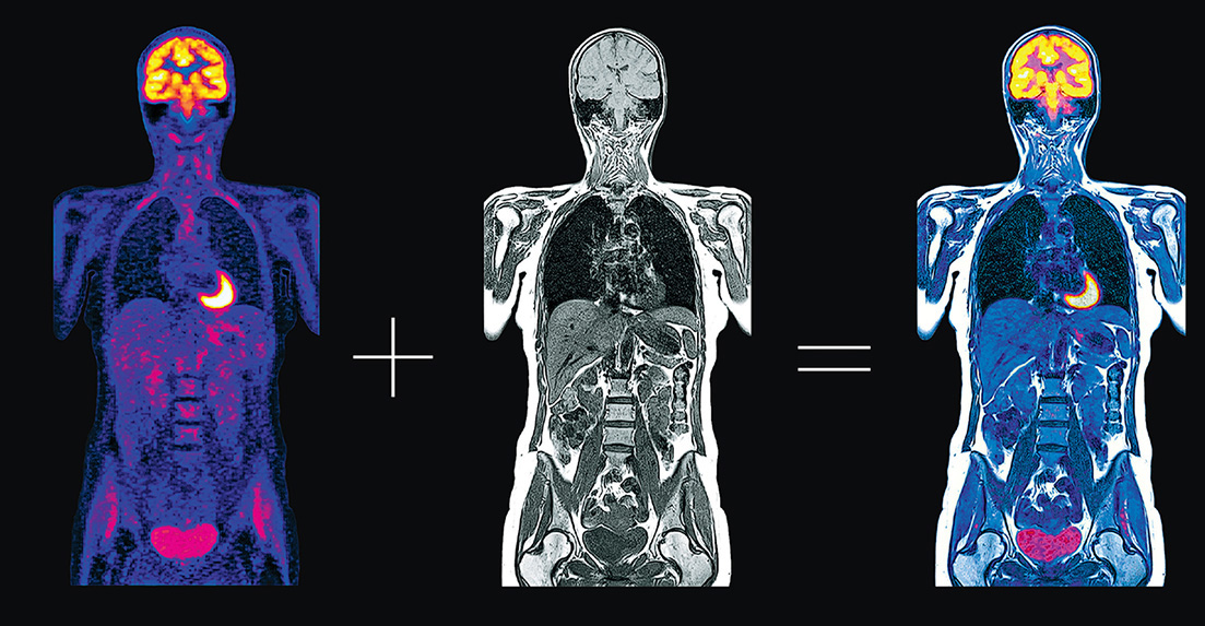 Microwaves May Take on Medical Diagnostics | Microwaves & RF